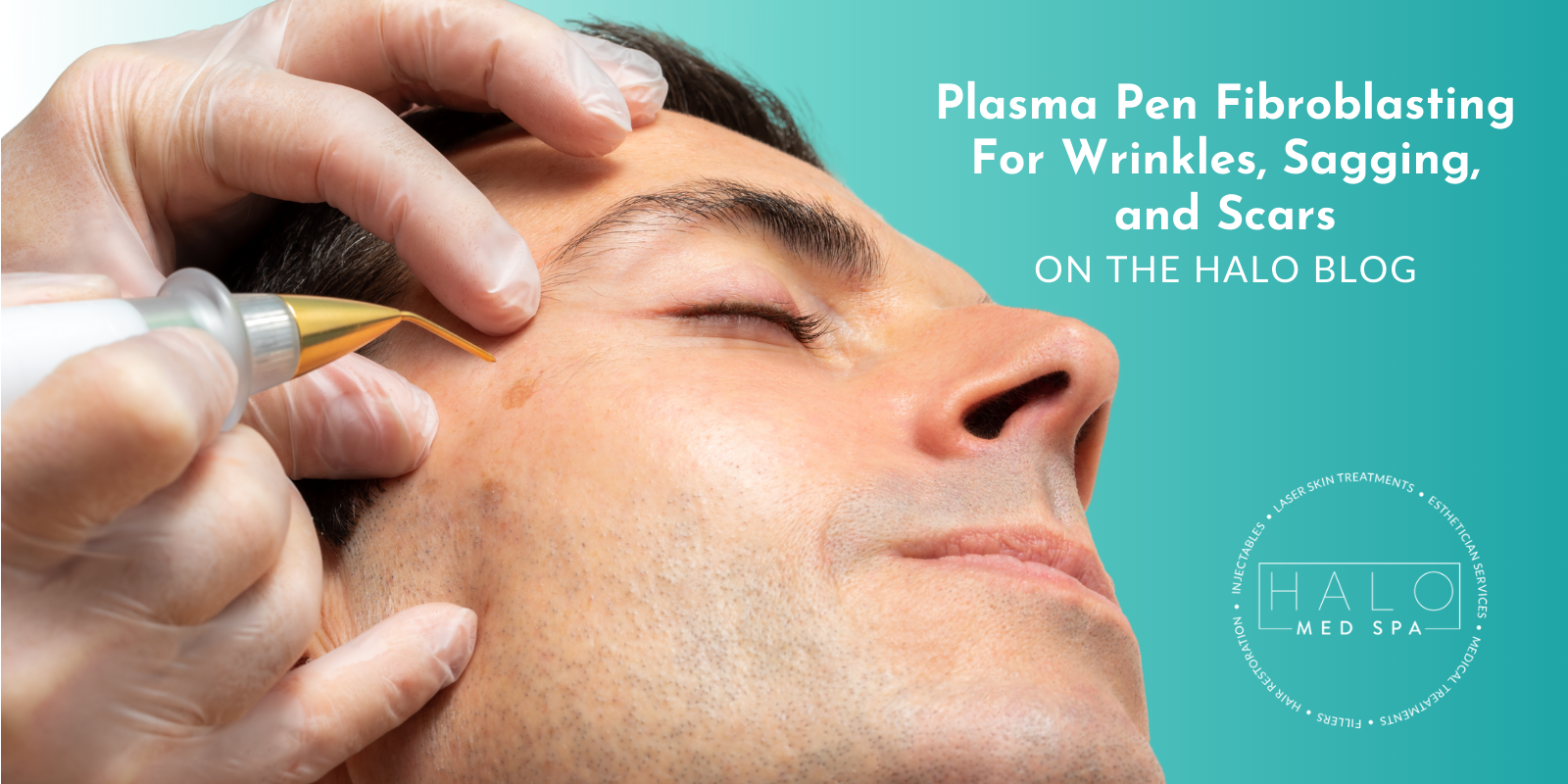 Plasma Pen Fibroblasting For Wrinkles, Sagging, and Scars – Courtney Hess